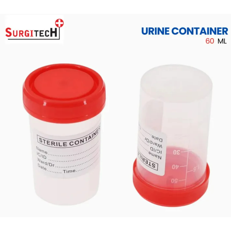 Surgitech Urine/Stool Specimen Container with Label 60ml 1PC | Shopee ...