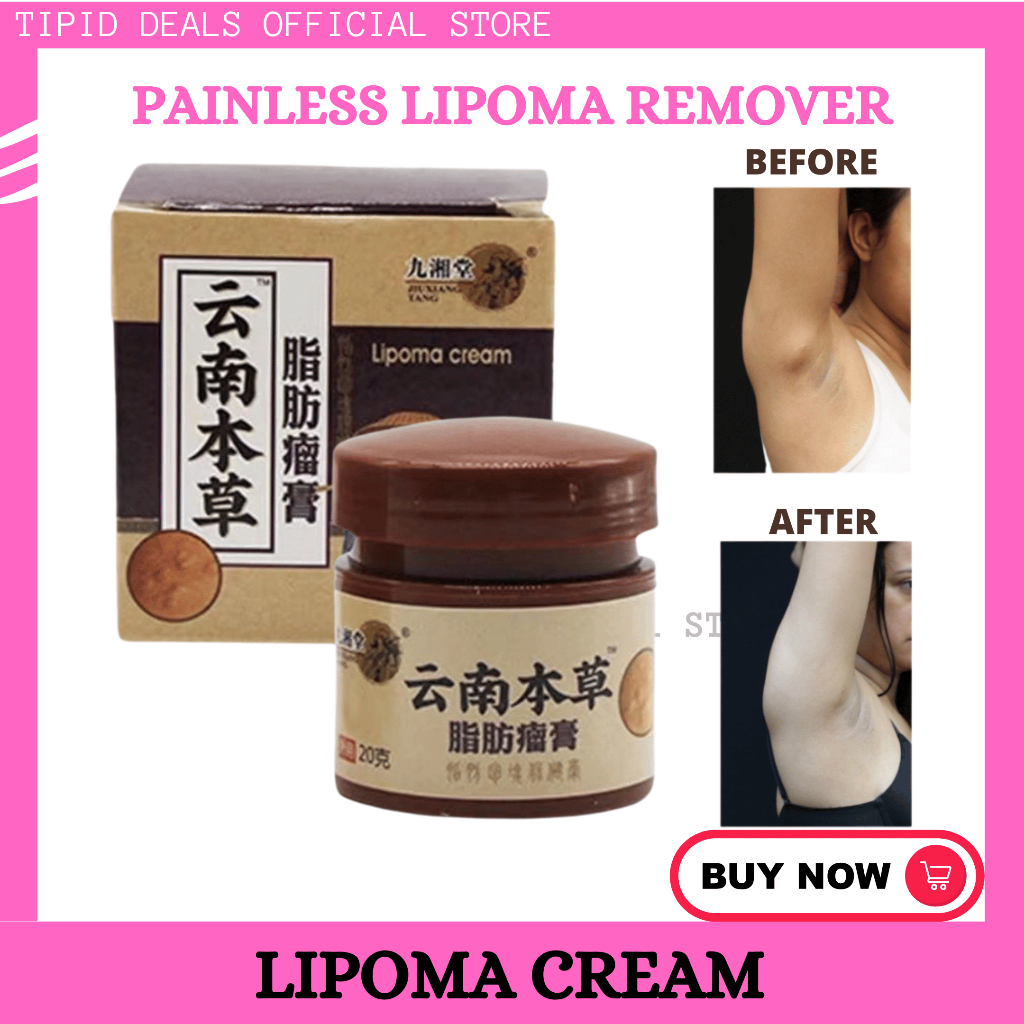 Original Lipoma Removal Cream Made in Japan | Herbal Treatment for ...