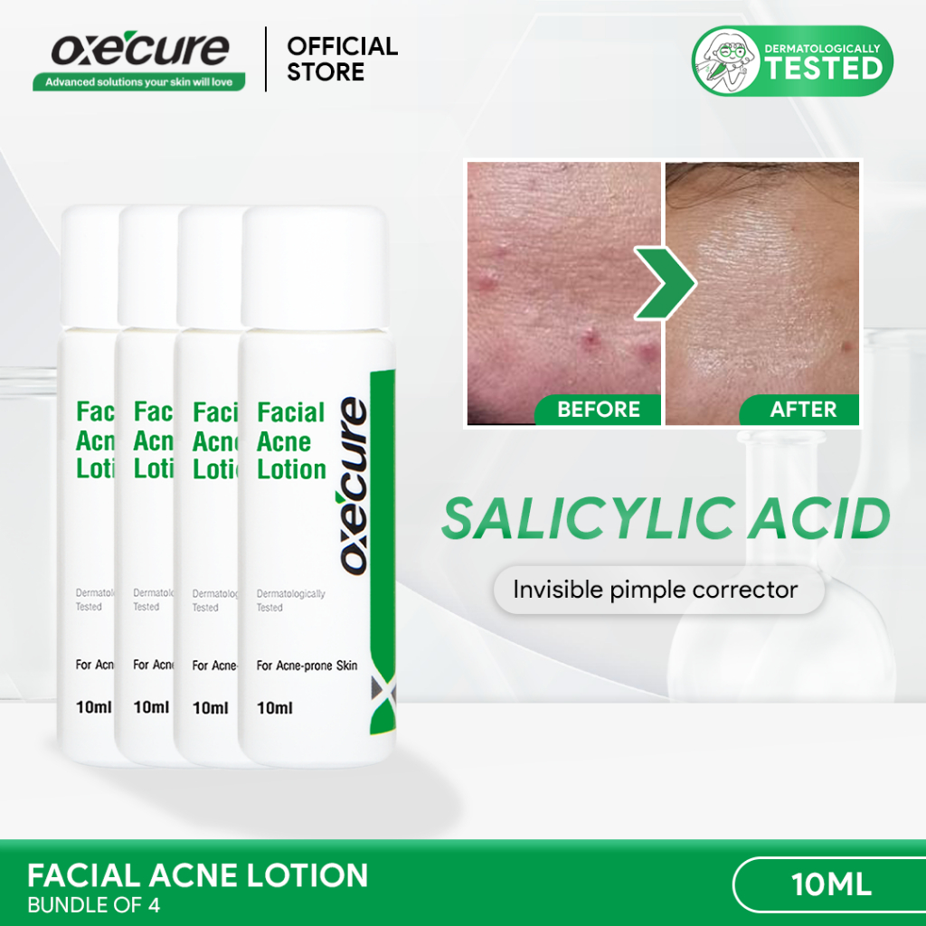 [NEAR EXPIRY: SEPT 2025] OXECURE 2% Salicylic Acid Facial Acne Lotion ...