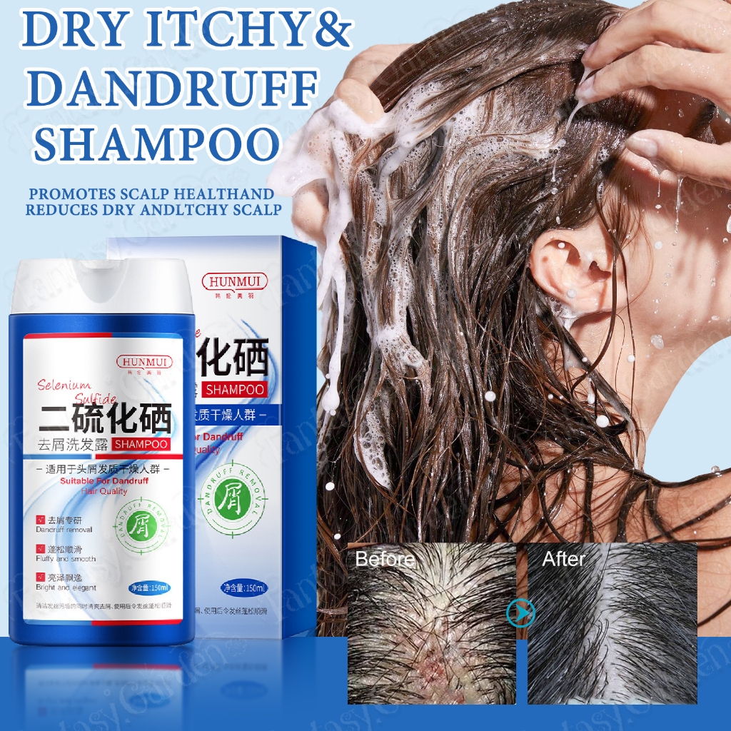 Selenium Sulfide Shampoo Anti-dandruff Anti-itching Oil Control and Mite Removal Refreshing ...