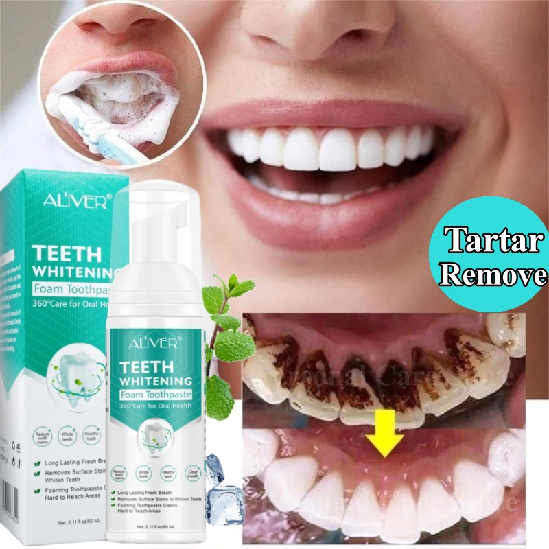 ALIVER Teeth Whitening Mousse Toothpaste Remove Plaque Mouth Odor ...