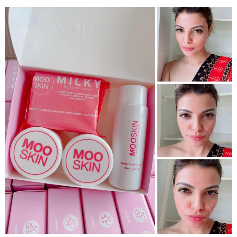 MOOSKIN MILKY RENEWAL SET | Shopee Philippines
