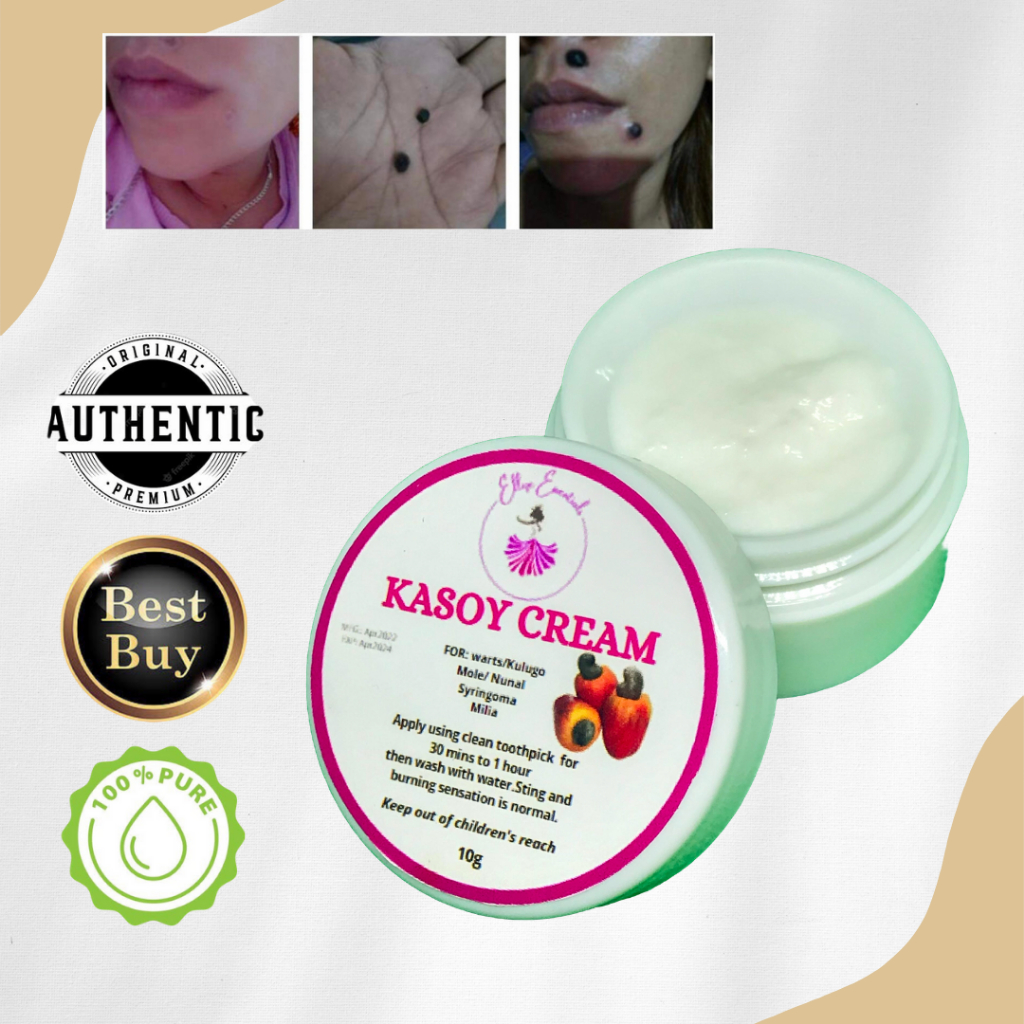 Kasoy Cream Effective Remover of Kulugo, moles, milia, skintags & other ...