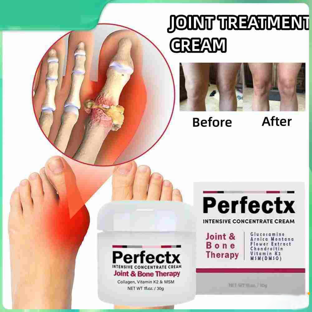 PERFECTX Joint Bone Therapy Cream Joint Knee Pain Treatment Effective ...