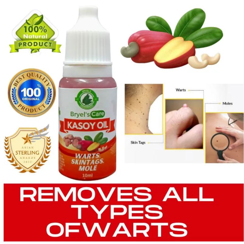 Kasoy Oil: Your Ultimate Solution for Warts, Moles, Skin Tags, Genital ...