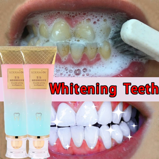 Niacinamide Toothpaste Whitening Teeth Tartar Removal for Teeth Plaqu ...