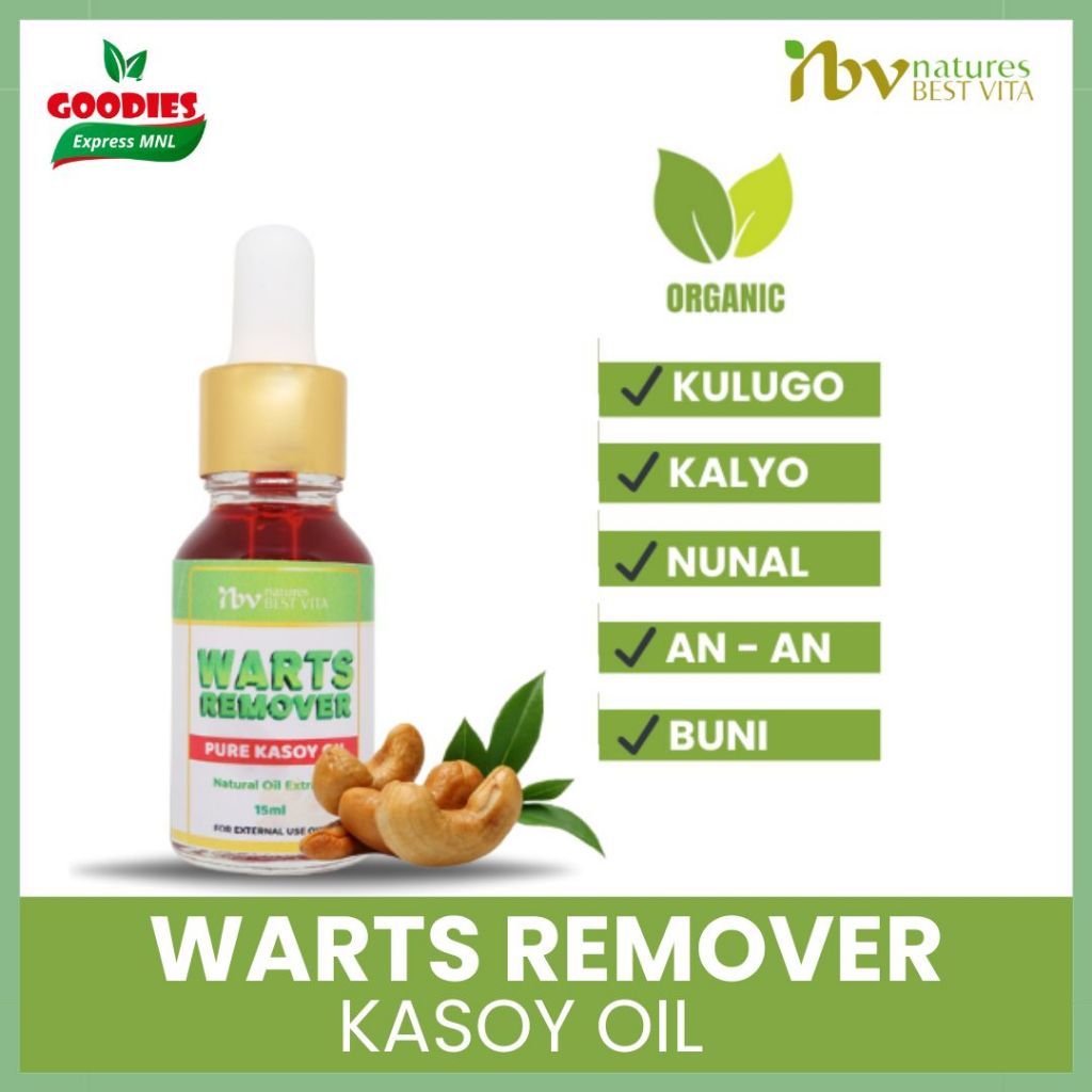 Warts Remover Pure Kasoy Oil Natures Best Vita Mole Remover Kulogo Buni ...