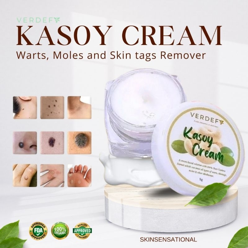 VERDEFY Strong Kasoy Cream - Effective Remover of Kulugo Moles Warts ...