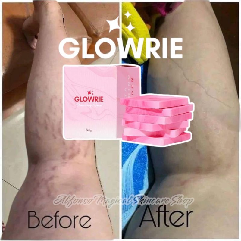 GLOWRIE BLEACHING SOAP | GLUTA COLLAGEN BLEACHING WHITENING SCAR REMOVER SOAP PACK 300grams ...