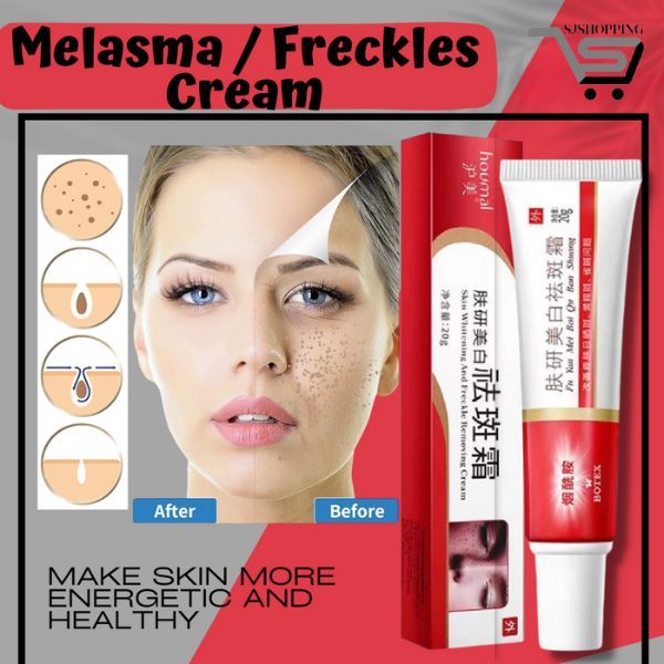 3pcs Melasma Cream Pekas & Freckle Remover Collagen Japan Original ...