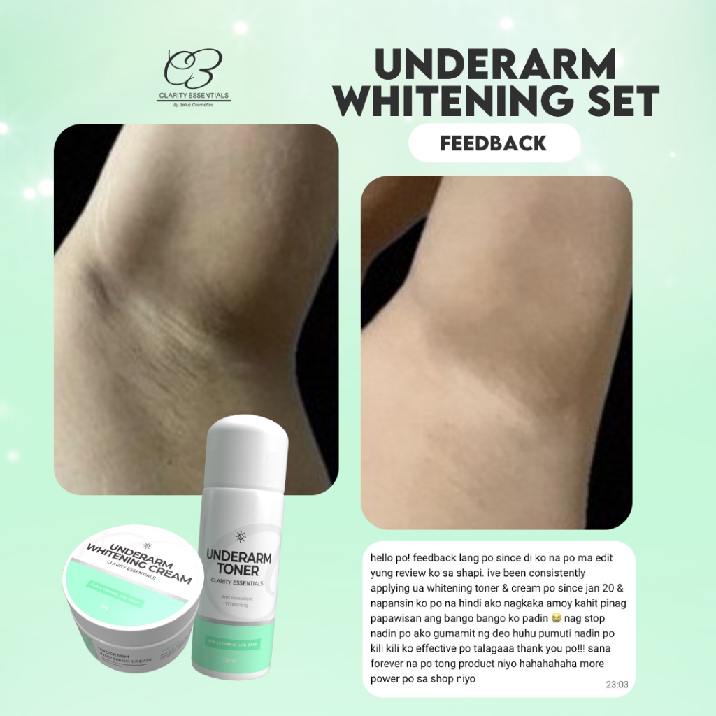 Underarm Whitening Set | Whitening Toner and Underarm Whitening Cream ...