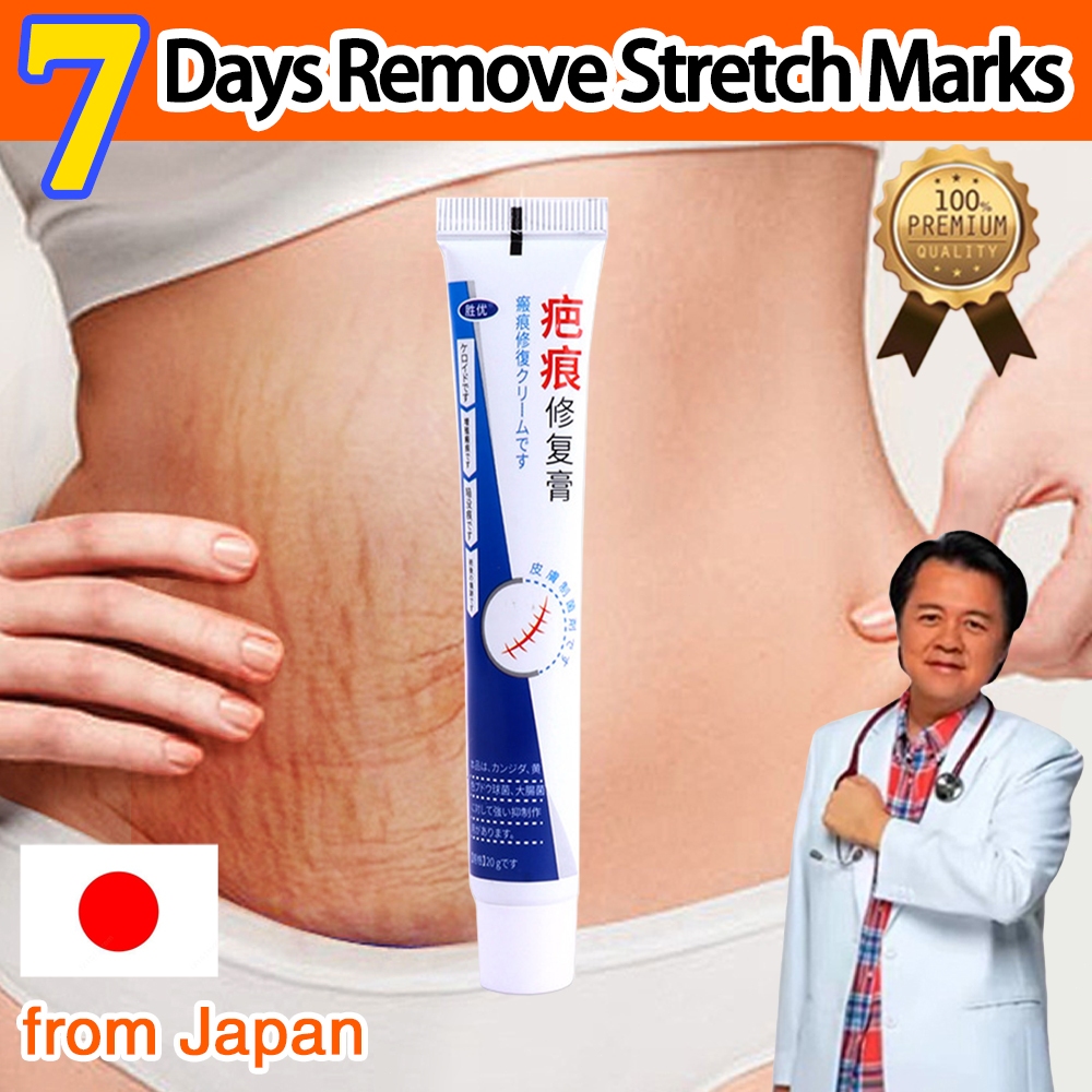 Stretch Marks Remover Cream Original Scars Peklat Keloid Removal ...