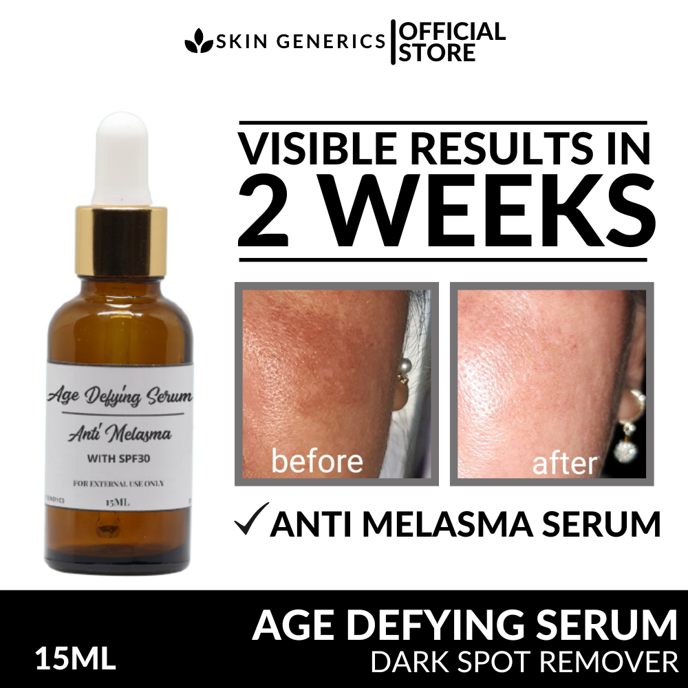 [ ANTI AGING + MELASMA SERUM ] SkinGenerics Anti Melasma Age Defying ...