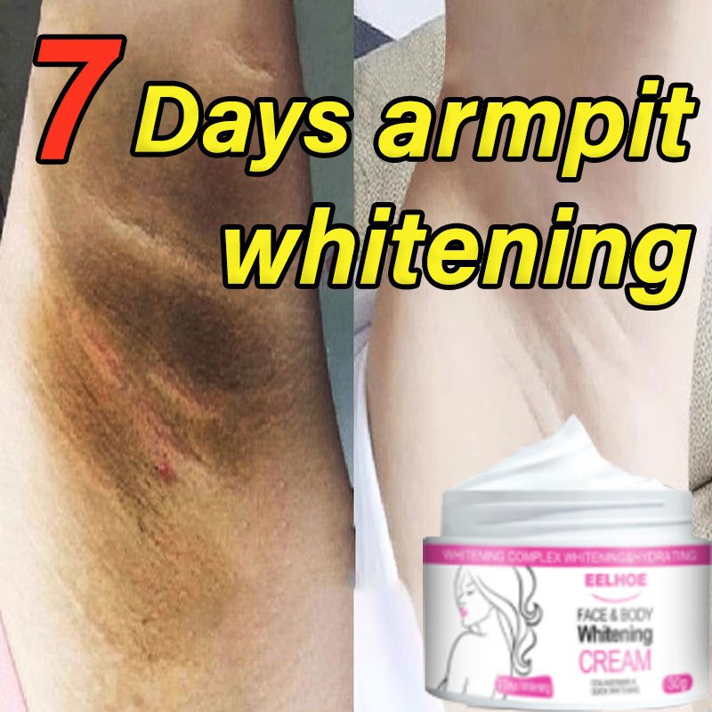 Anti Melanin Whitening Cream For Private Parts Underarm Whitening Face ...