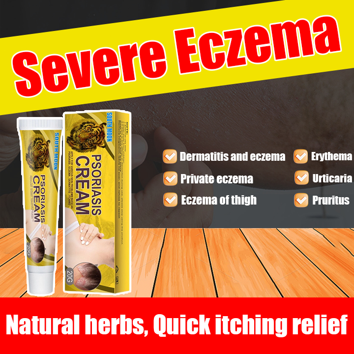 Psoriasis Cream Dermatitis Eczematoid Eczema Pruritus Ointment Antibacterial Cream Itching