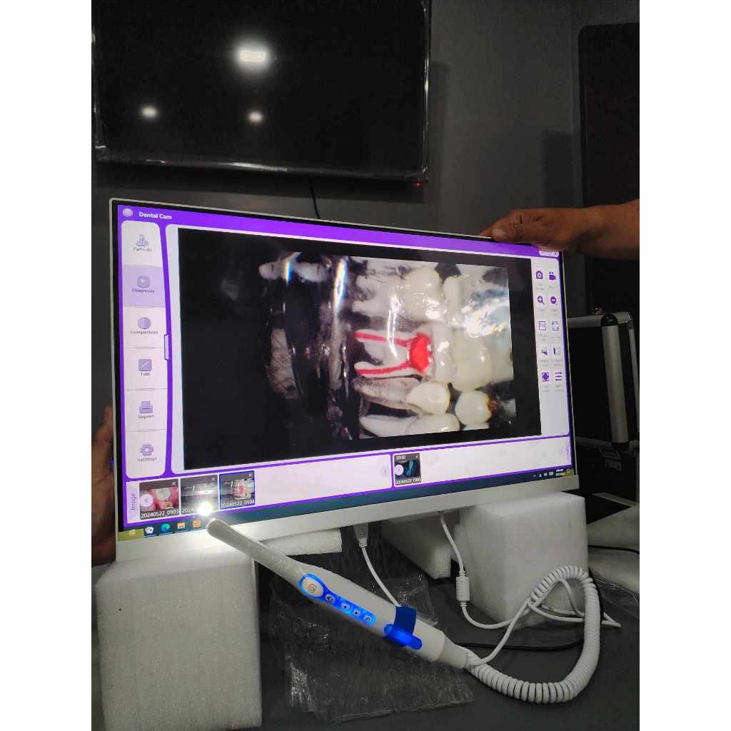 Tradent Intraoral Camera 24inch Touchscreen Monitor with built-in ...
