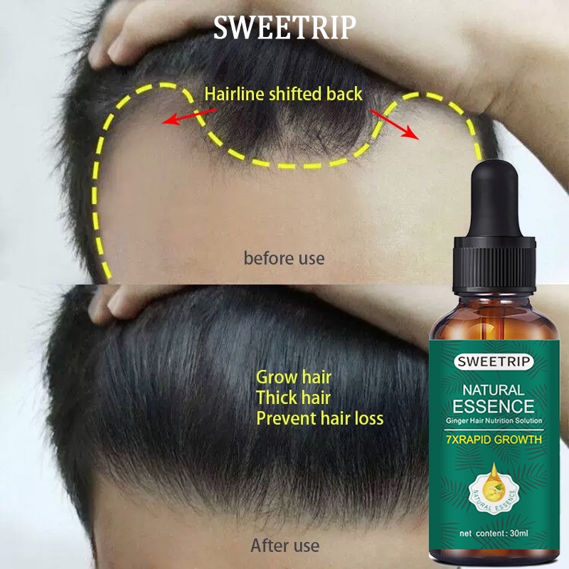 30ml COD Hair Growth Essence Serum Hair Loss Treatment Preventing ...