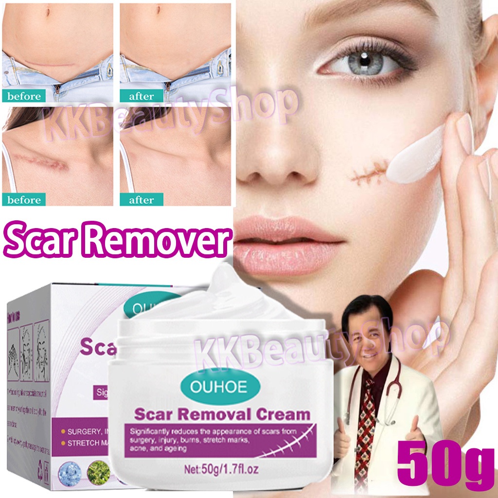 Scar Remover Cream Original For Old Scar Peklat Remover Stretch Mark ...