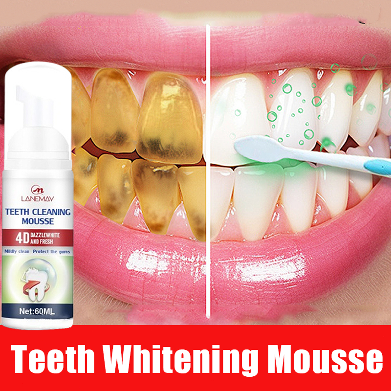 Teeth Whitening Mousse Toothpaste Kit Oral Tooth Hygiene Teeth Cleaning ...