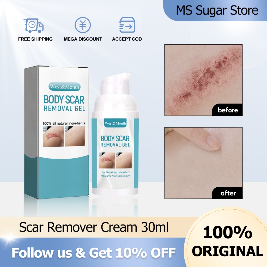West Month Scar Remover Cream 30ml Peklat Remover Old Scar Care Acne ...