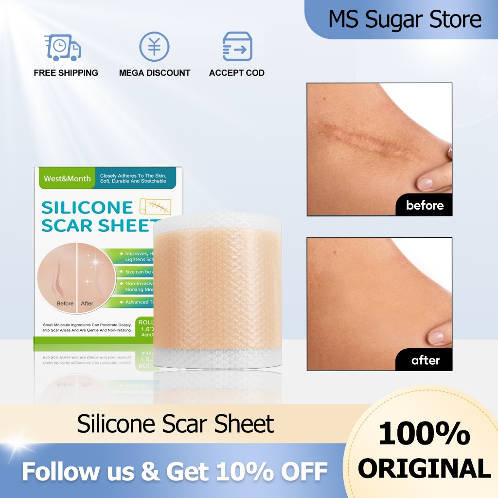 West&Month Silicone Scar Sheet 1Roll Scar Remover Scar Patch Waterproof ...