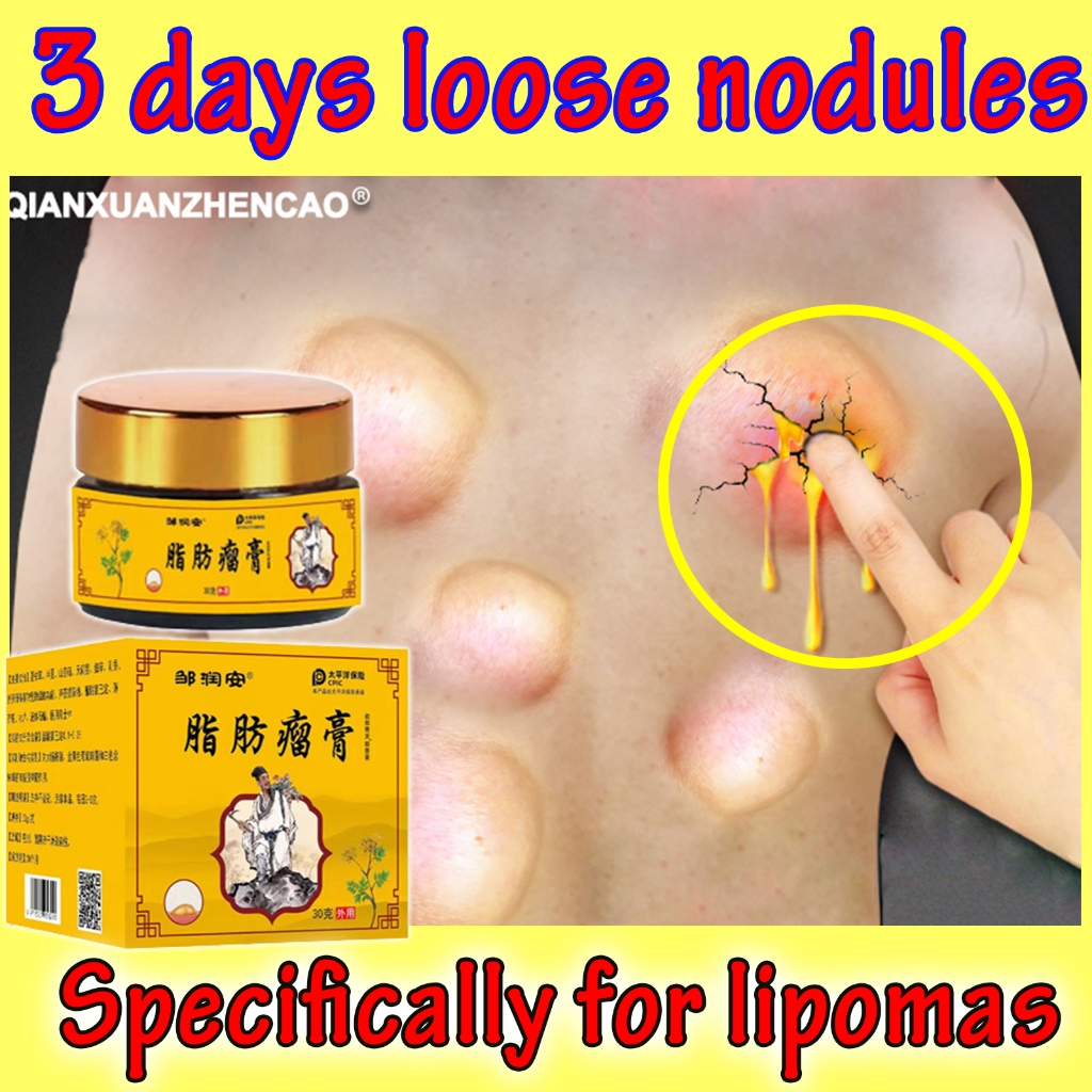 30g kuyo para sa pigsa authentic lipomas remover cream from japan ...