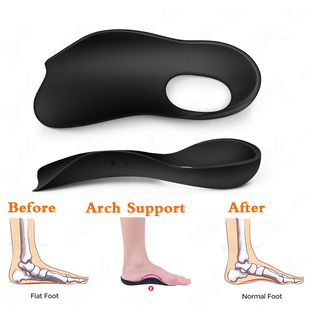 Flatfoot XO-Legs Orthotics Large Size Insoles For Flat Foot O-shaped ...