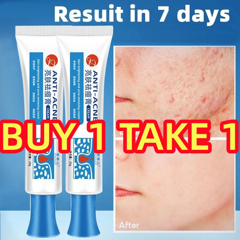【BUY 1 TAKE 1】Effective Remove Pimples Quickly Pimple Remover Acne Cream Fades Acne Marks ...