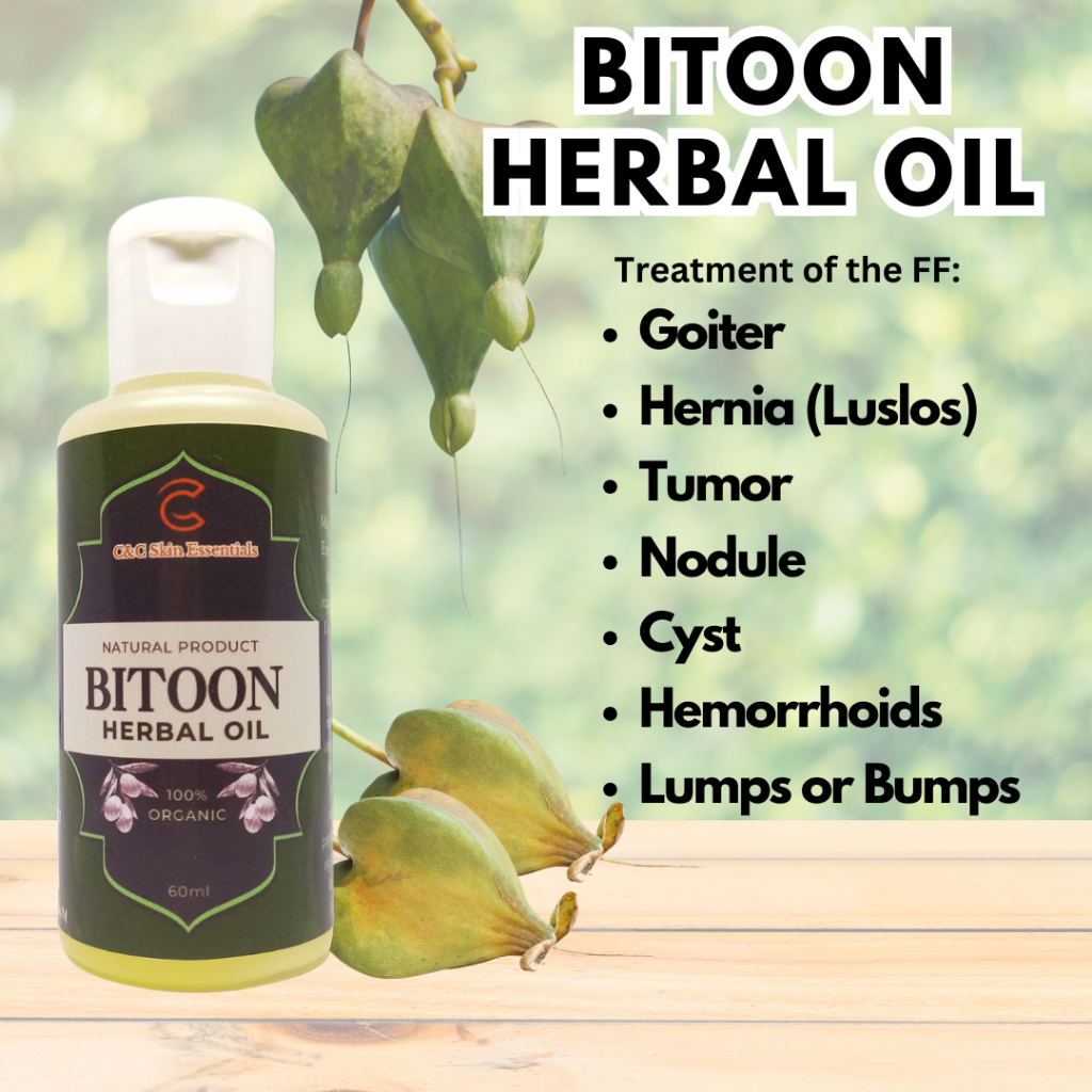 Bitoon Herbal Oil for Bukol: Original and Effective Pantunaw ng mga Bukol /Sea Poison Tree Oil ...