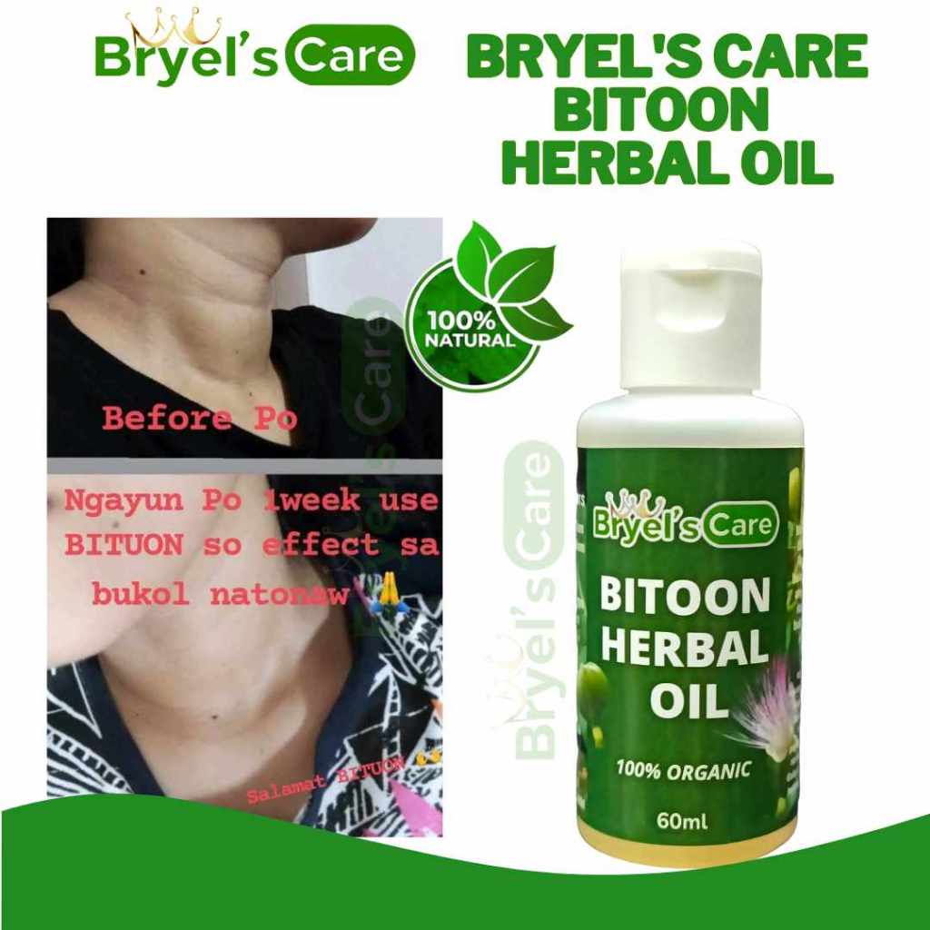 Bitoon Herbal Oil 60ml Anti Body Bumps Mabisang Pangtunaw Sa Lahat Ng Uri Ng Mga Bukol Sa