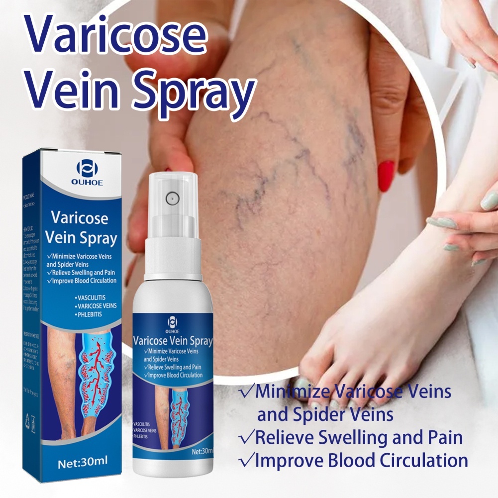 Varicose Vein Massage Spray treatment spider varicose vein remover ...