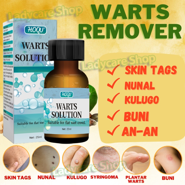Warts Remover Original Painless Kulugo Remover Solution Skin Tags Mole ...