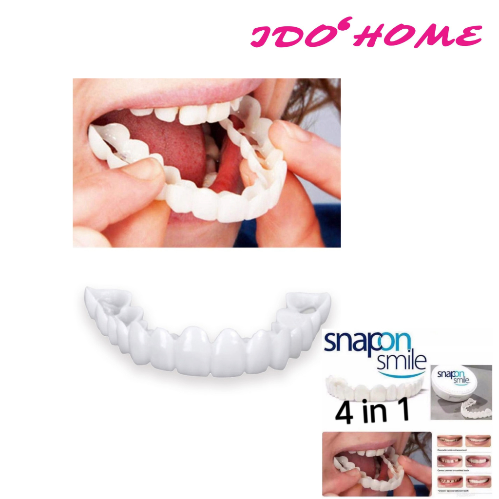 SNAP ON SMILE INSTANT SMILE VENEER SNAPON | Shopee Philippines