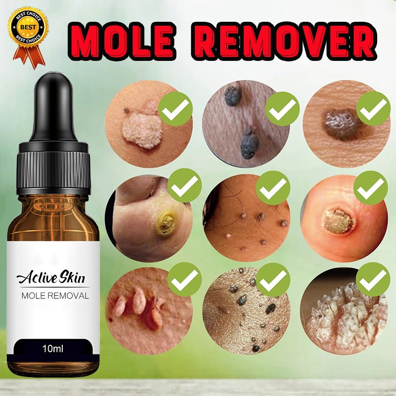 Warts Remover Original Serum Wart Papillomas Removal Kulugo Anti Skin ...