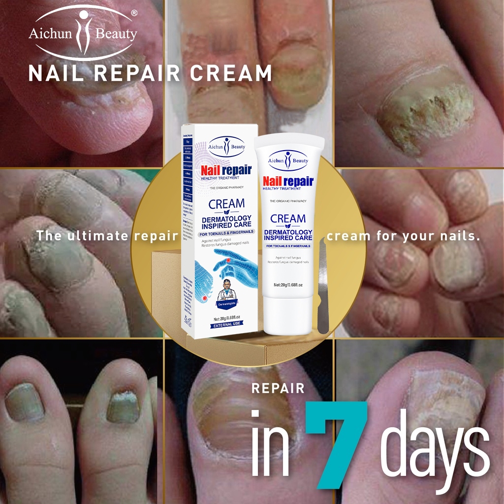 Antibacterial Nail Treatment Anti Fungus Infection Toe Nursing ...