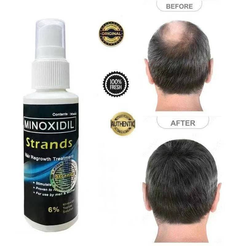 Hair Grower Minoxidil Strands 6% Minoxidil Topical Solution beard ...