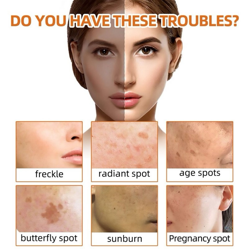 PYARY TURMERIC SOAP 70G | Shopee Philippines