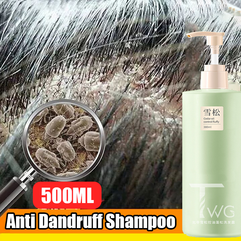 Anti dandruff shampoo hair treatment Dandruff remover Oil control 380ml ...