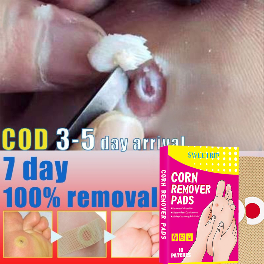 SWEETRIP 10PCS Foot Corns Remover Patch Warts Remover Pads Corn and ...