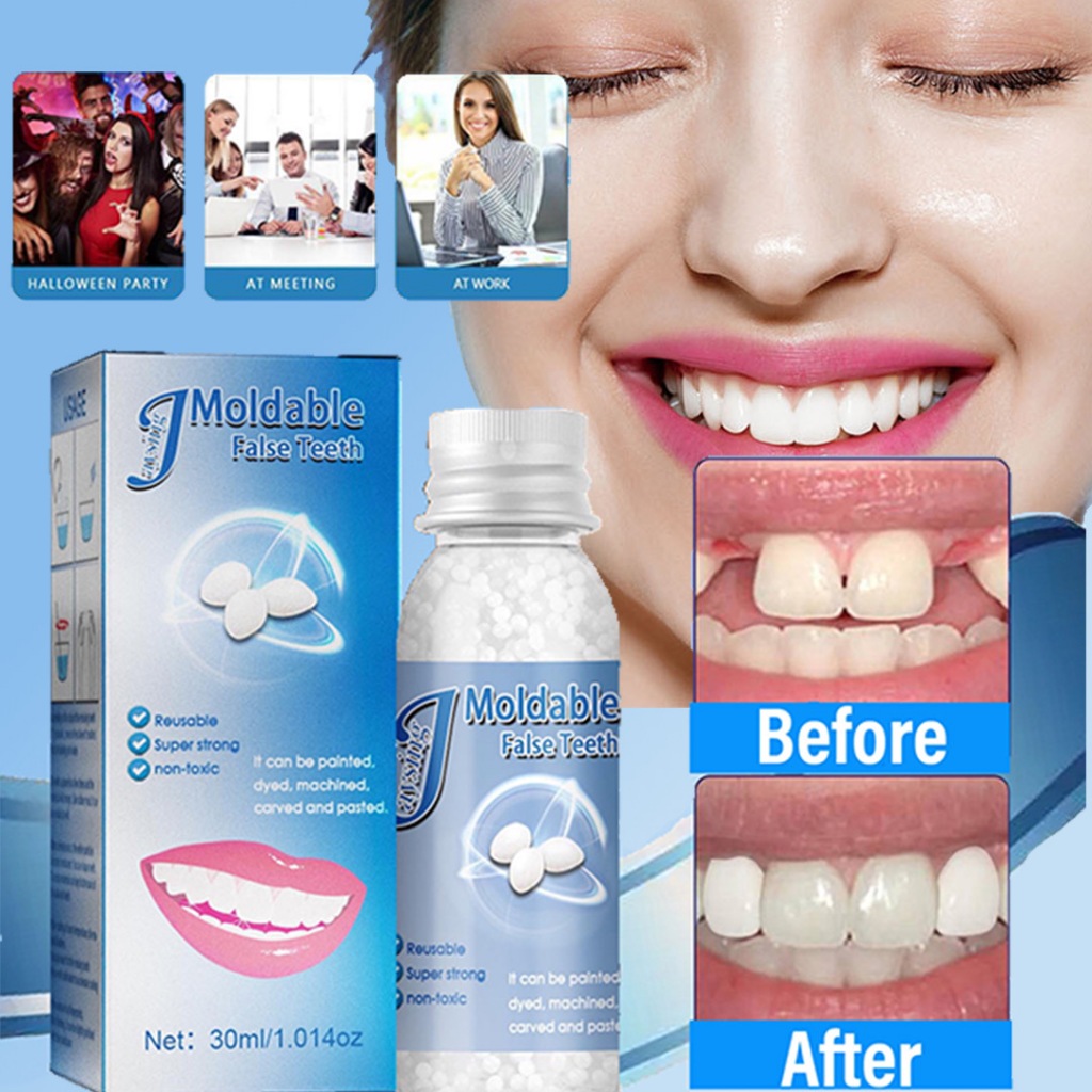 Temporary Tooth Repair Kit Filling Teeth Gaps Moldable False Teeth ...
