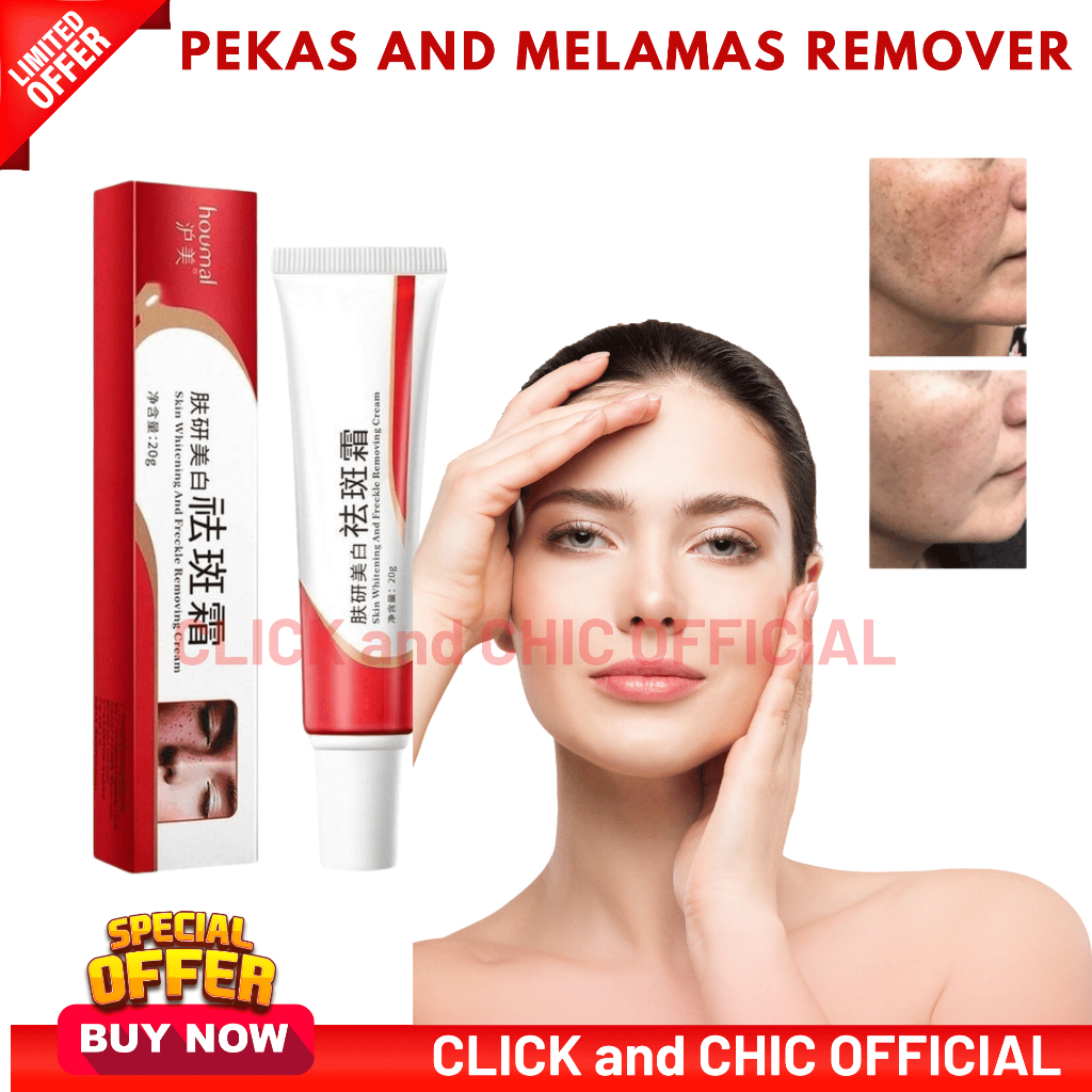 Pekas Cream Remover Original - Japanese Melasma Cream Whitening - Whitening Moisturizer | Shopee ...