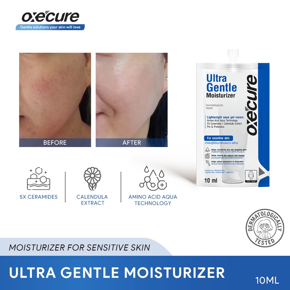 OXECURE Ultra Gentle Moisturizer 10ml | Shopee Philippines