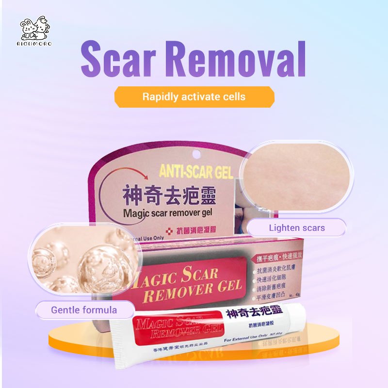 Authentic magic Scar Remover Gel Anti-Scar | Shopee Philippines