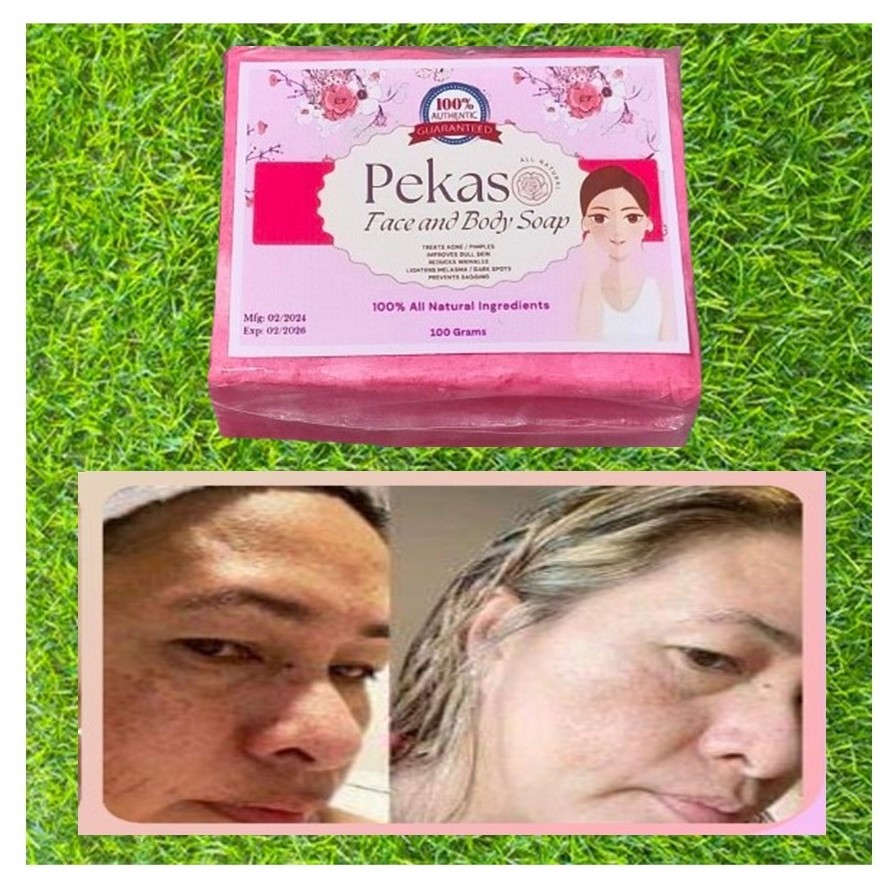 ORIGINAL PEKAS SOAP, ORIGINAL TRENDING PEKAS AND MELASMA REMOVER Skin ...