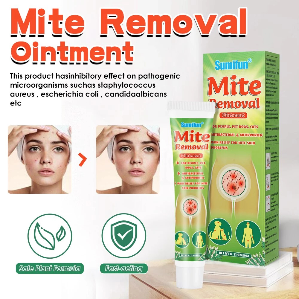 Mite Removal Ointment cream Lice Natural Anti Mites Remove For People ...