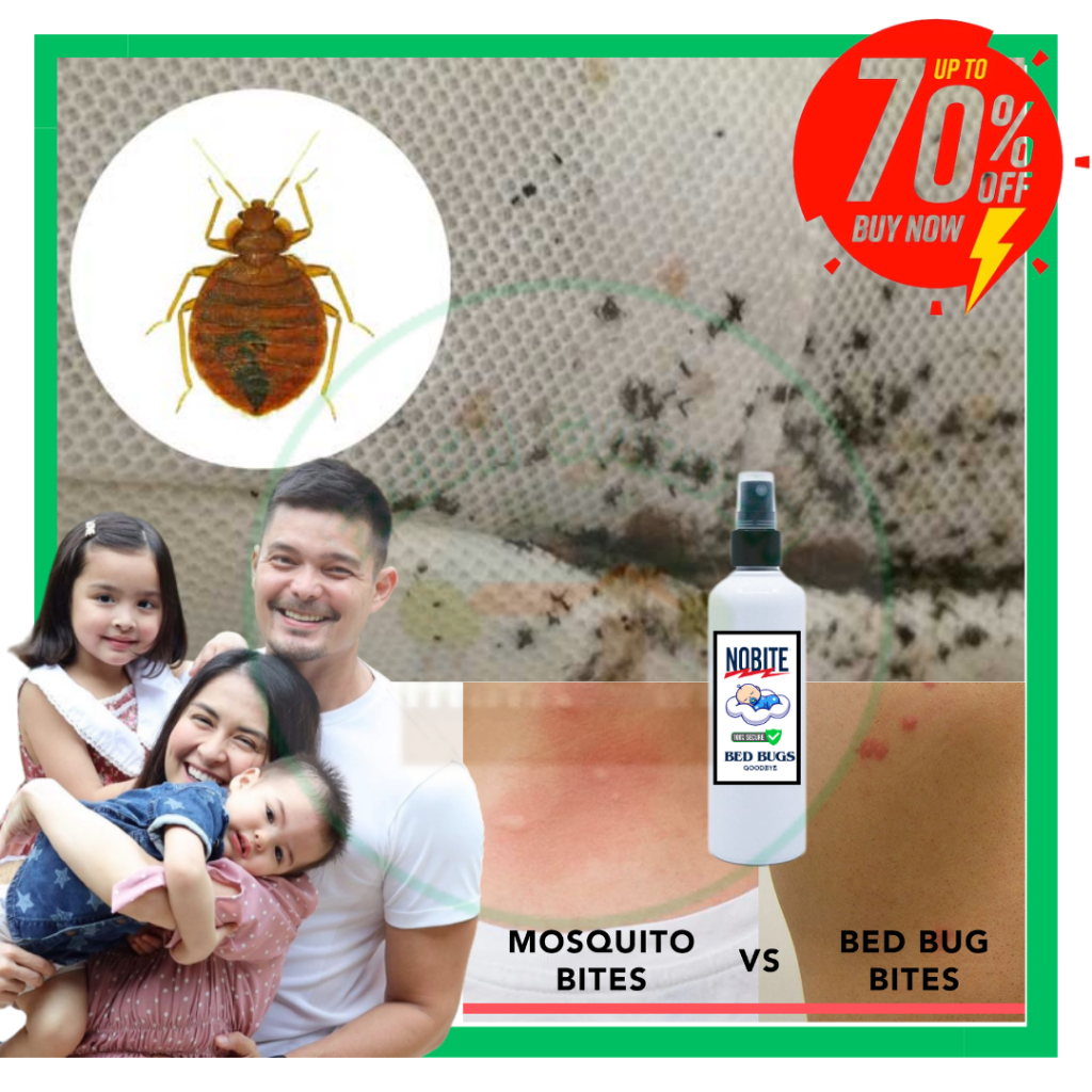 250 ML BedBugs GoodBye // Pamatay Surot // bed bug killer | Shopee ...
