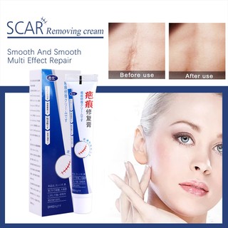 Scars Remover Cream Gel Original From Japan For Old Scar Care ...
