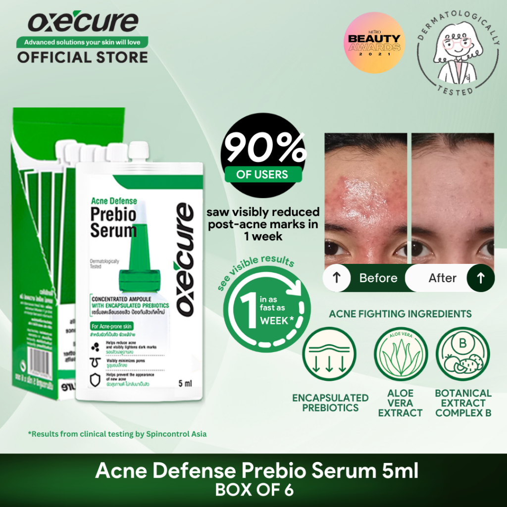 OXECURE Acne Defense Prebio Serum 5ml Box of 6 | Shopee Philippines