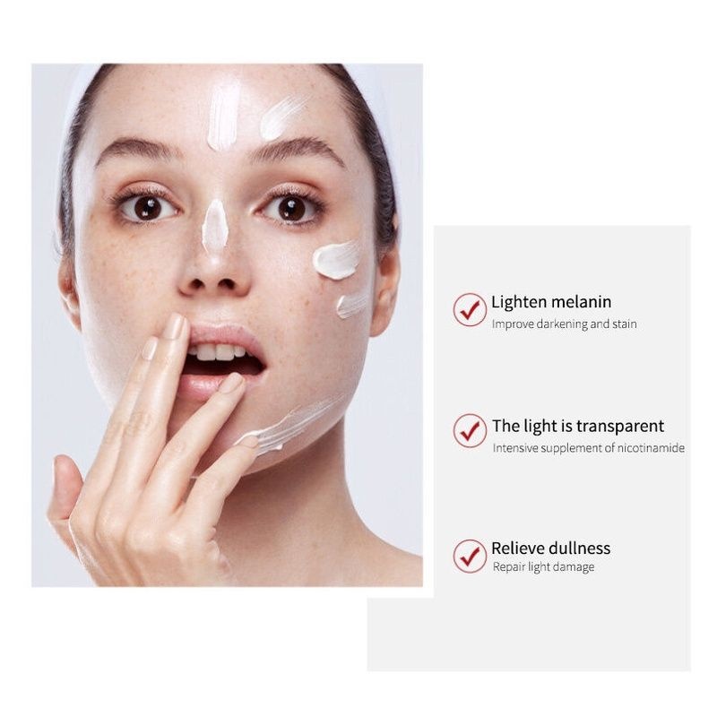 Pekas Remover Melasma Cream Original Collagen Japan Original Freckles ...