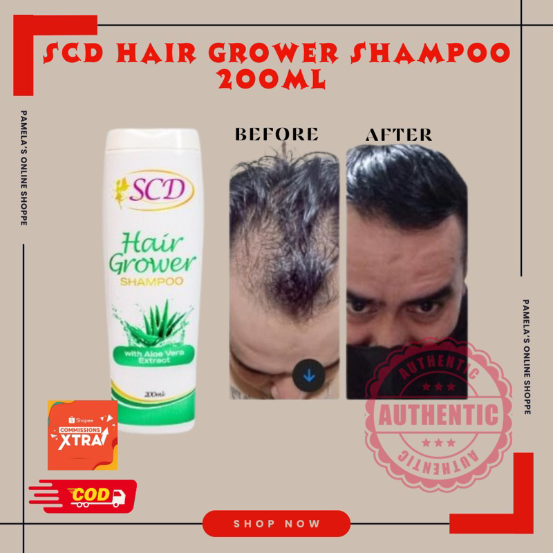 SCD Hair Grower Shampoo 200ml | Shopee Philippines